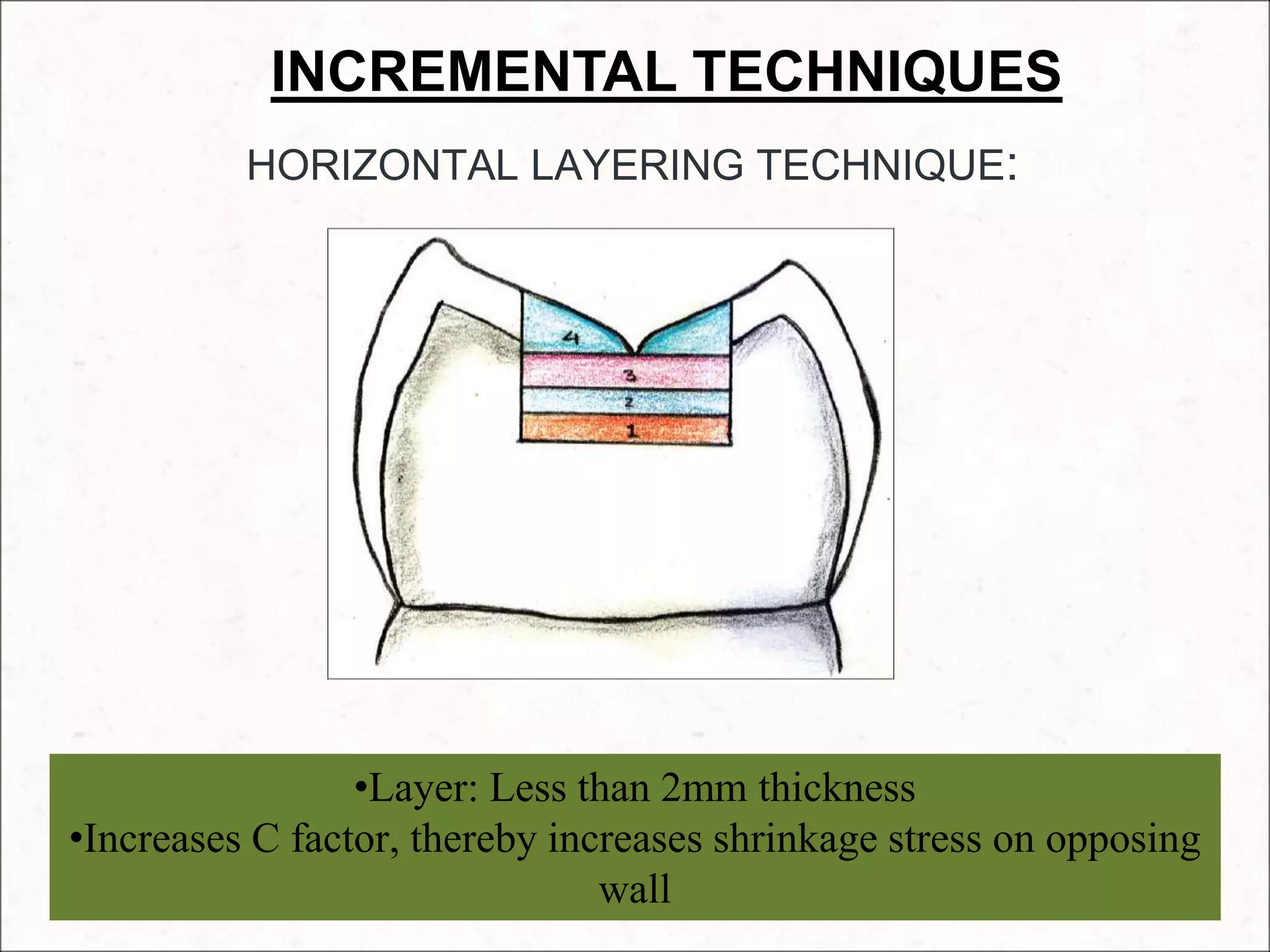 Techniques of direct composite restoration | PPT