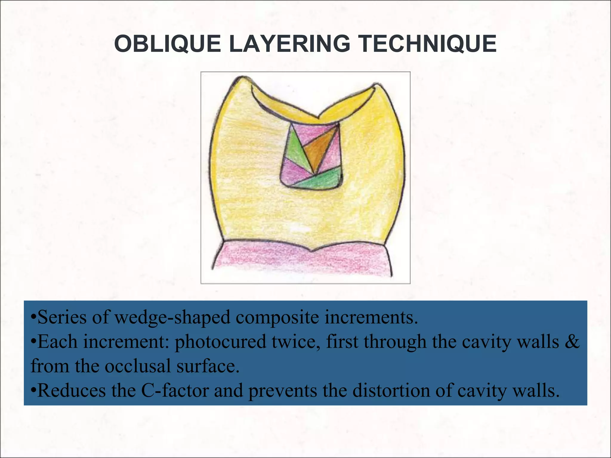 Techniques of direct composite restoration | PPT