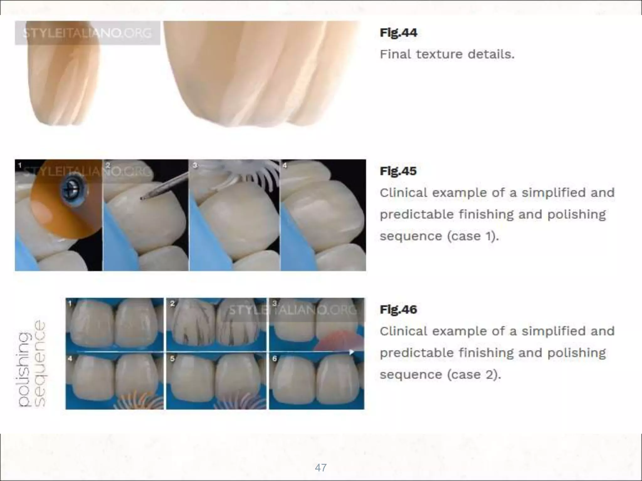 Techniques of direct composite restoration | PPT