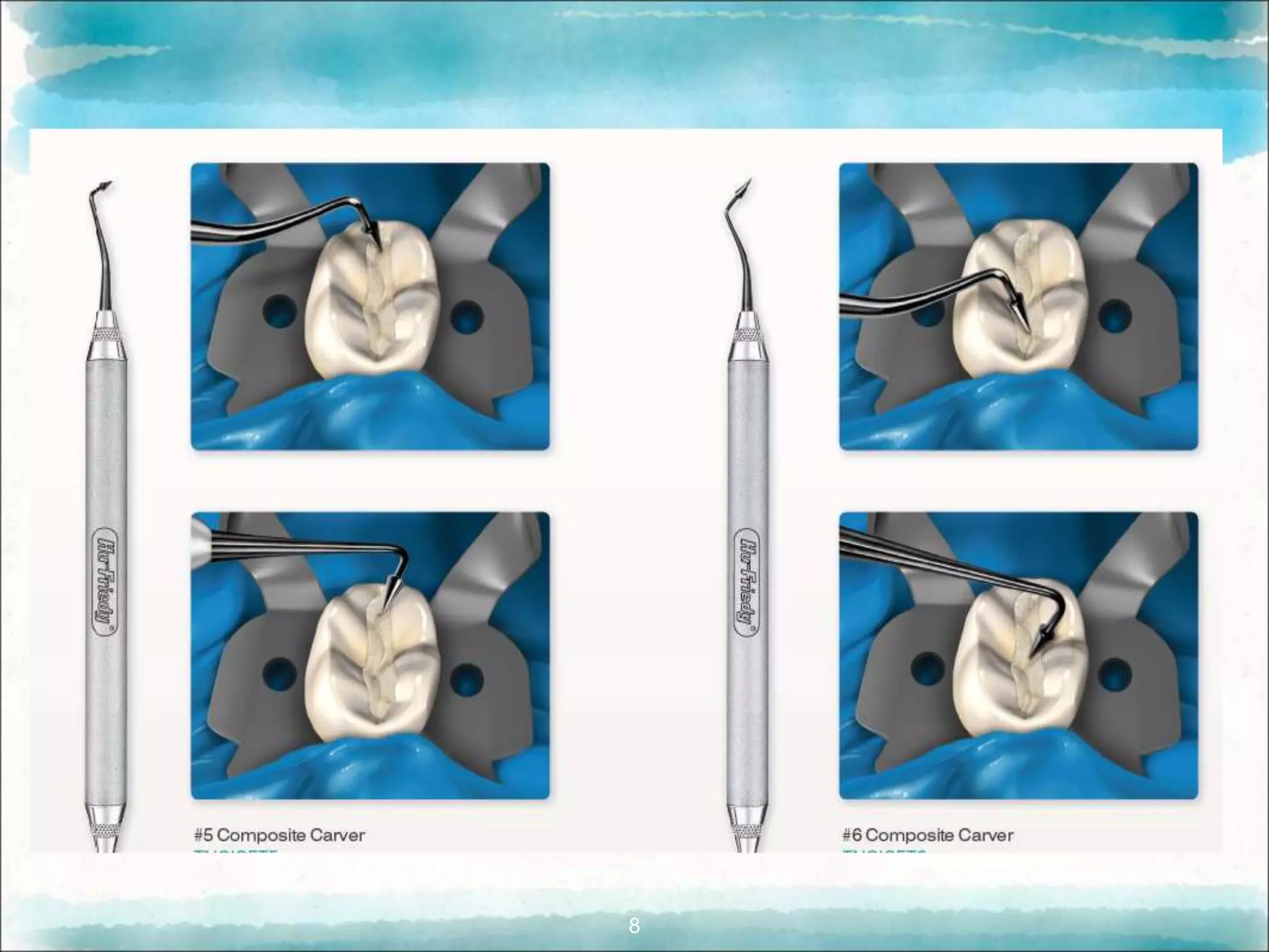 Techniques of direct composite restoration | PPT