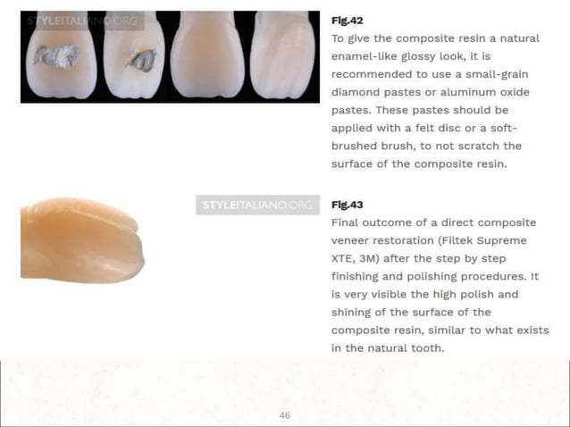 Techniques of direct composite restoration | PPT