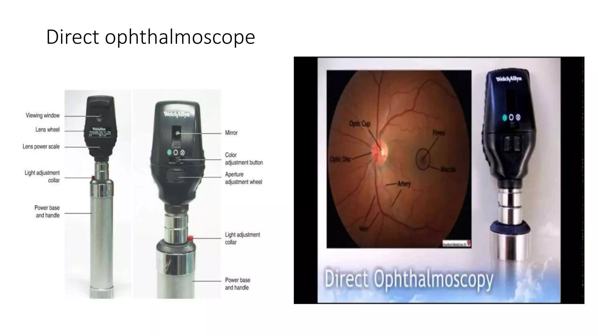 Techniques of fundus | PPTX