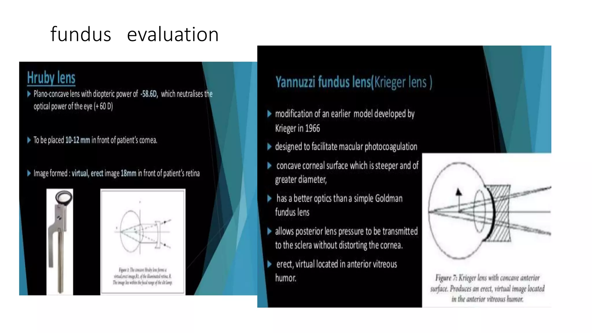 Techniques of fundus | PPTX