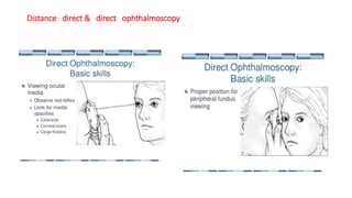 Techniques of fundus | PPTX