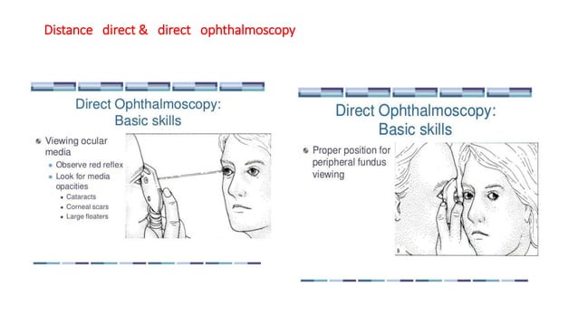 Techniques of fundus | PPTX | Eye and Vision Conditions | Diseases and ...
