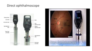 Techniques of fundus | PPTX
