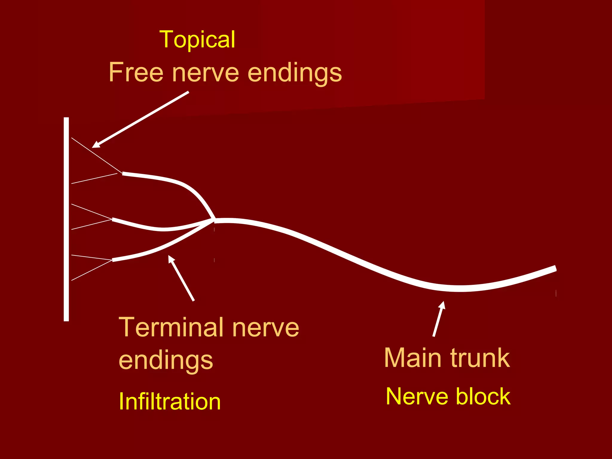Techniques of Local Anesthesia | PPT