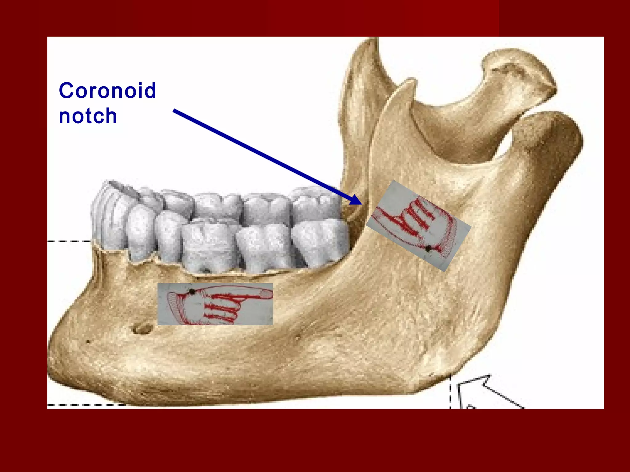 Techniques of Local Anesthesia | PPT