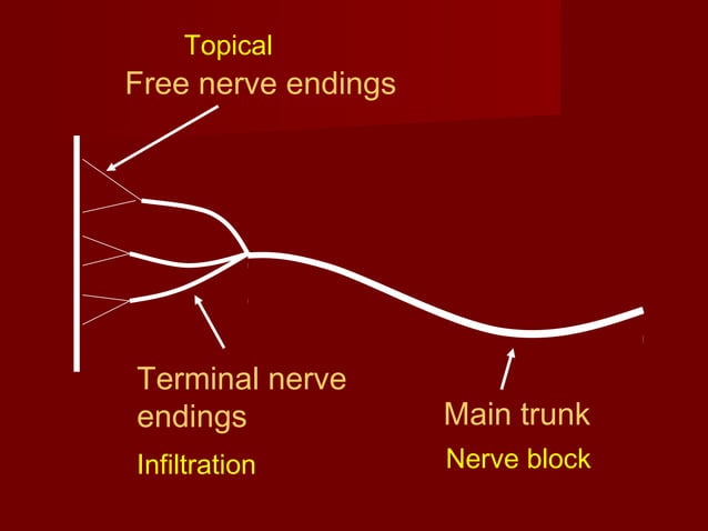 Techniques of Local Anesthesia | PPT
