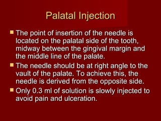 Techniques of Local Anesthesia | PPT