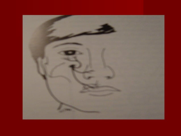 Techniques of Local Anesthesia | PPT