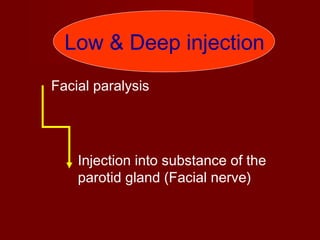 Techniques of Local Anesthesia | PPT