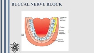 Techniques of local anesthesia in dentistry IN A NUTSHELL | PPTX