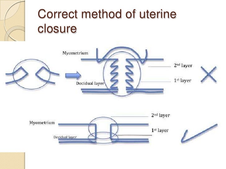 Techniques of lscs a review