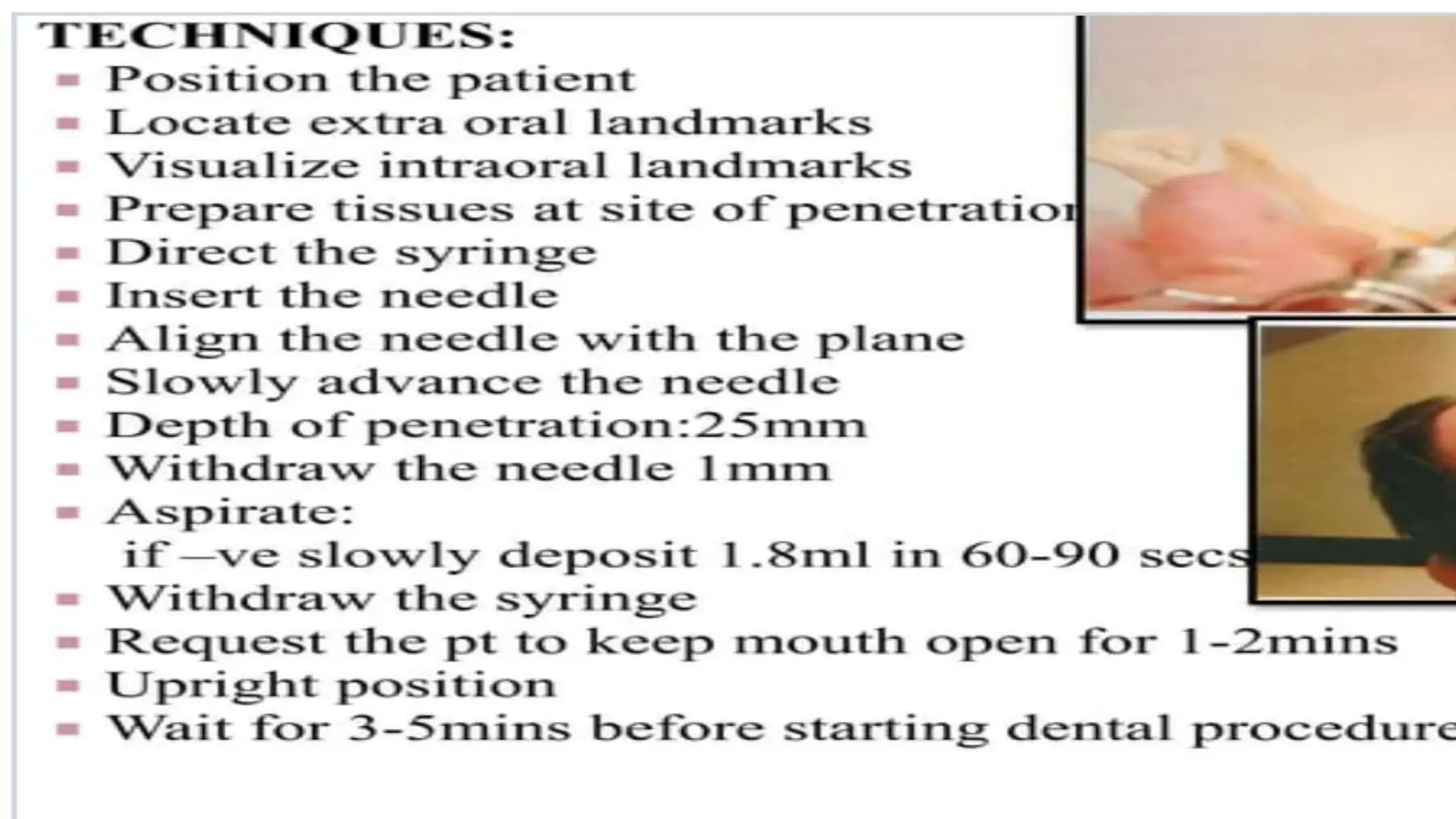 Techniques of mandibular anesthesia.pptx