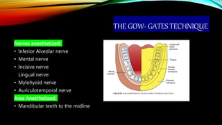 Techniques of mandibular anesthesia.pptx