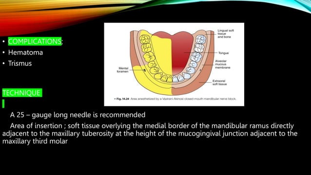 Techniques of mandibular anesthesia.pptx