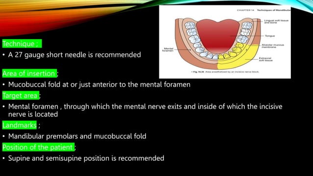 Techniques of mandibular anesthesia.pptx
