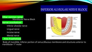 Techniques of mandibular anesthesia.pptx