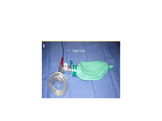 techniques of oxygen delivery.pptx........ | PPT