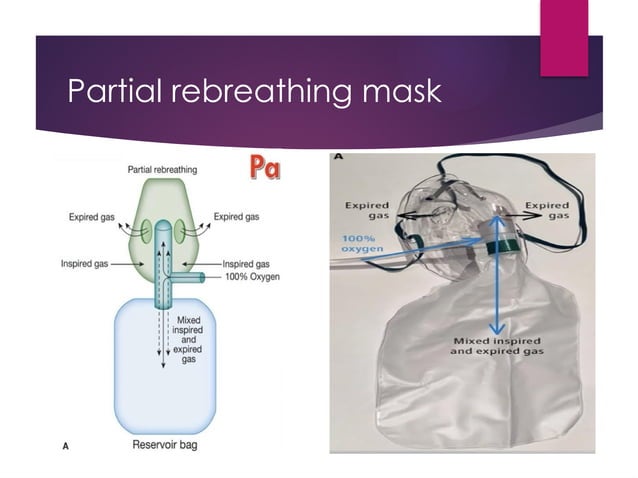 techniques of oxygen delivery in paediatrics.pptx | First Aid | Injuries