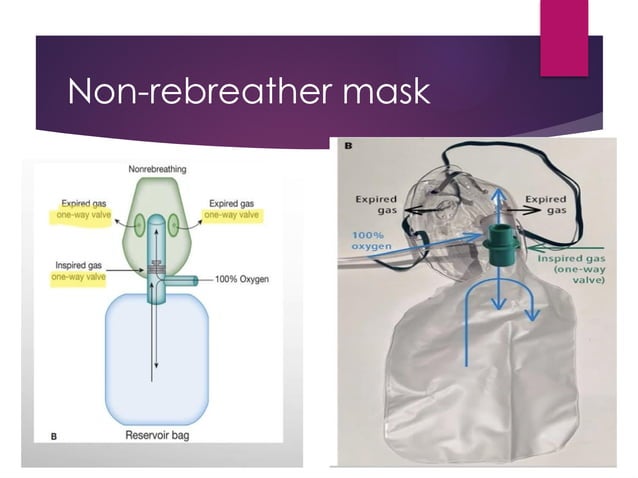 techniques of oxygen delivery in paediatrics.pptx | First Aid | Injuries