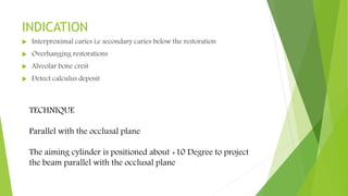 techniques of radiograph.pptx