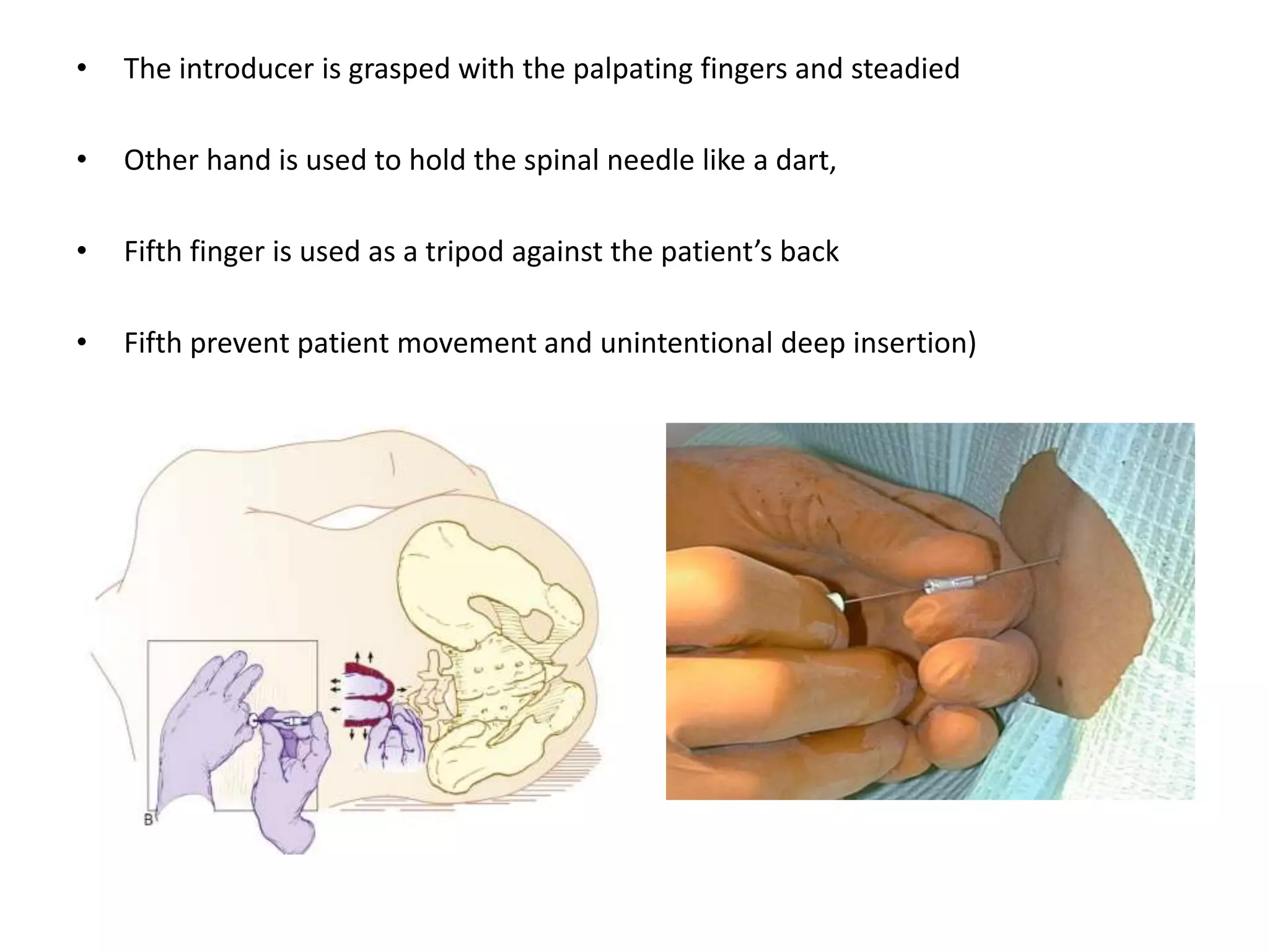 Techniques of spinal anaesthesia | PPTX