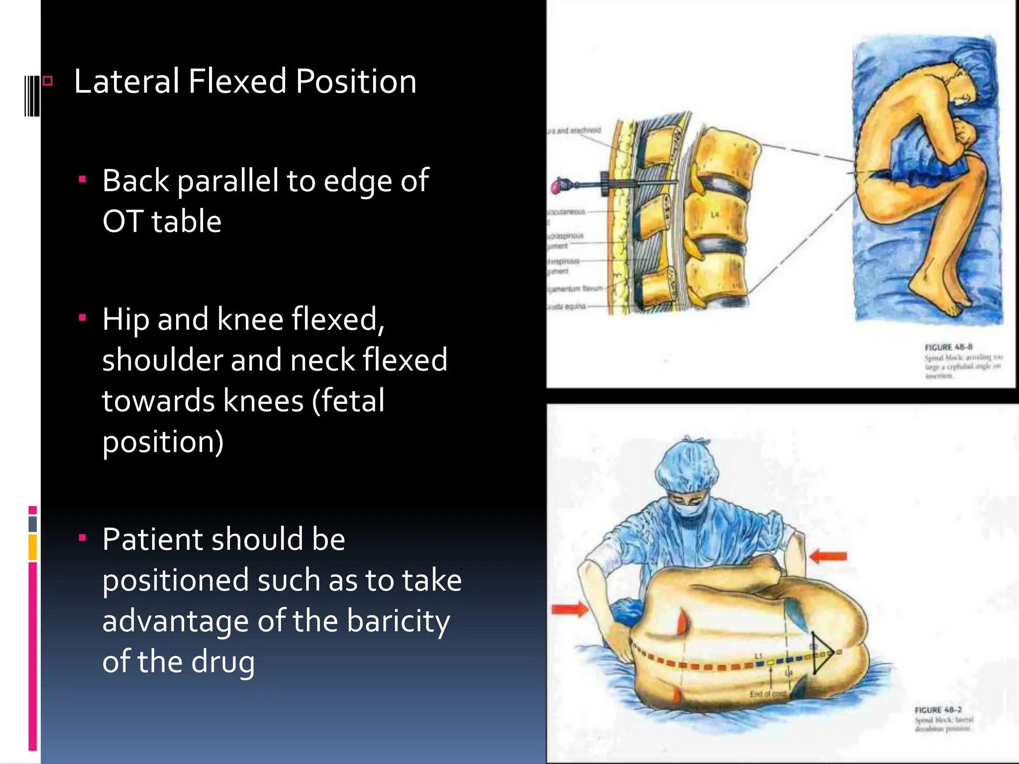 Techniques of the spinal anaesthesia.pptx