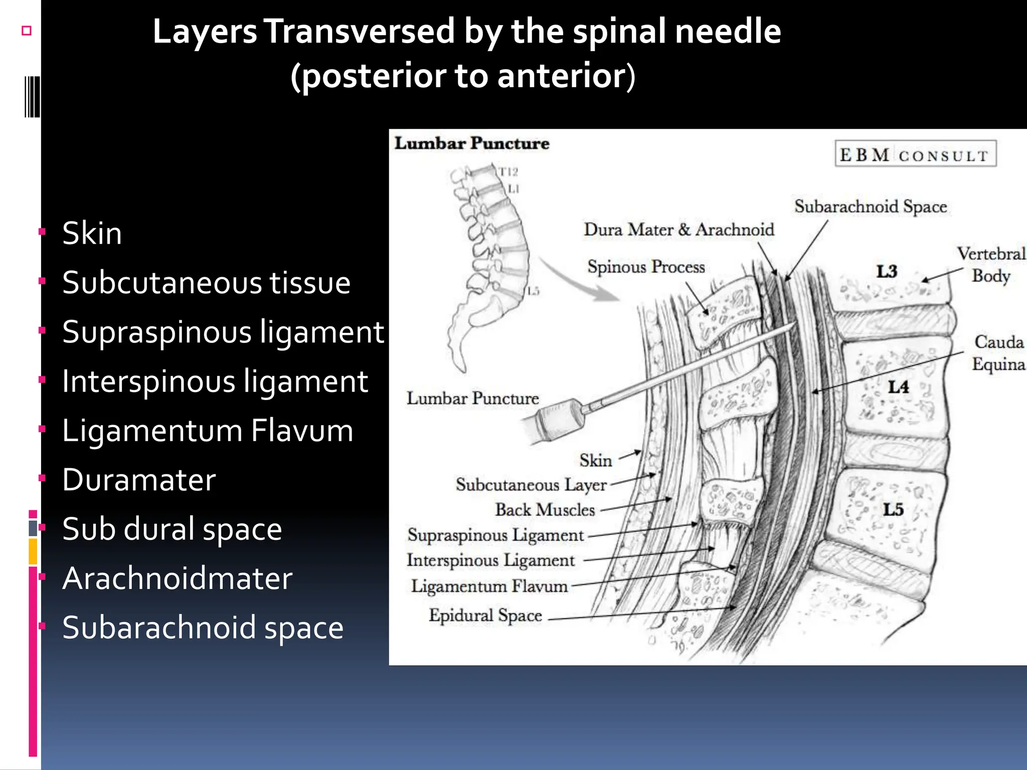 Techniques of the spinal anaesthesia.pptx