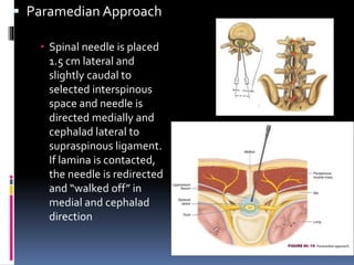 Techniques of the spinal anaesthesia.pptx
