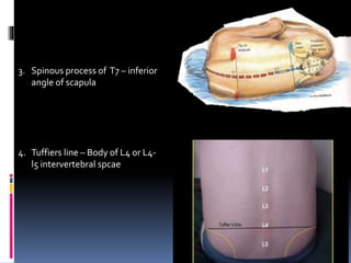 Techniques of the spinal anaesthesia.pptx
