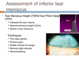 Techniques of tear film evaluation by Raju Kaiti | PPT
