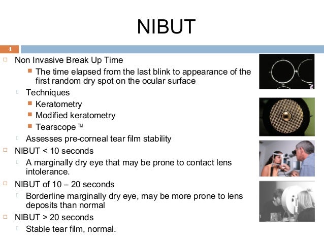 Techniques of tear film evaluation by Raju Kaiti