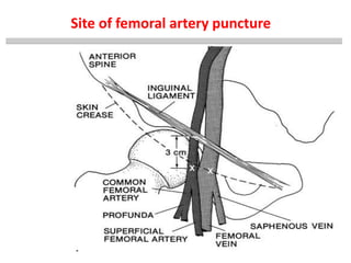 techniques of vascular access.ppsx