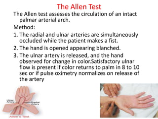 Techniques of Vascular acess for Cardiac Catheterization | PPSX