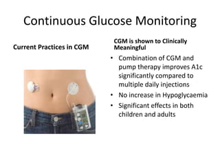 Technological development in Treatment of Diabetes | PPTX