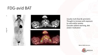 PET CT Variants and Recommendations for Patient Preparation. | PDF