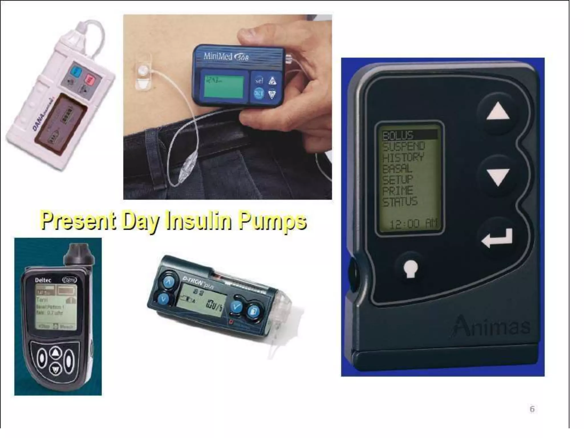 Technology in insulin delivery systems future directions.pptx