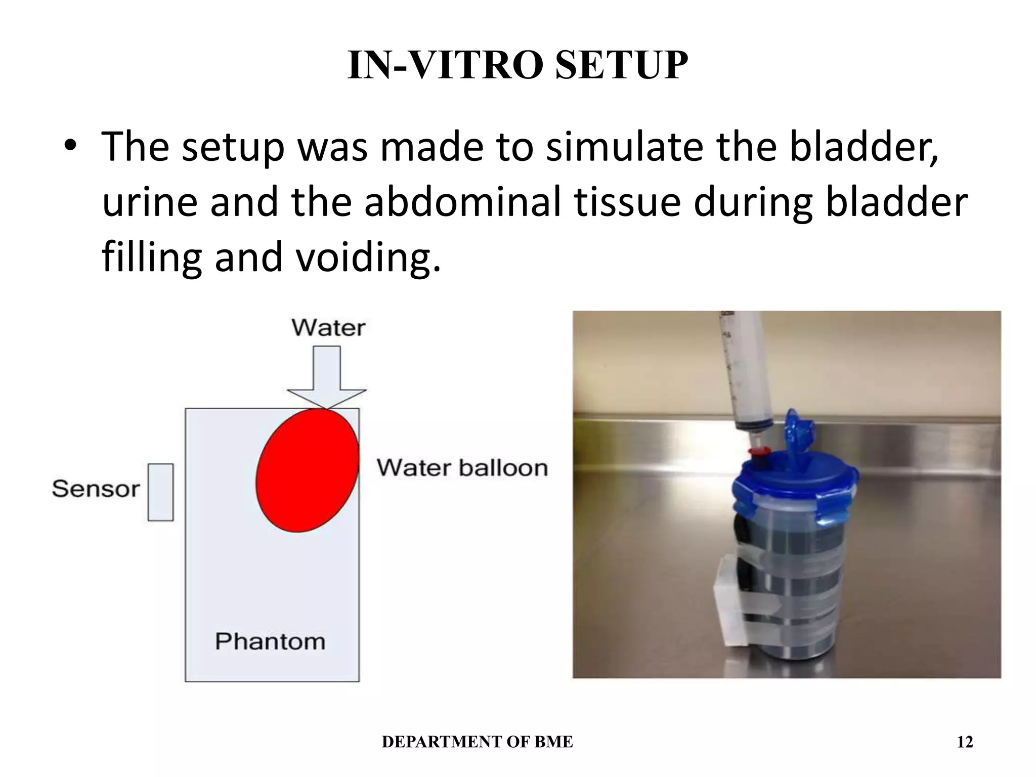 Monitoring of bladder filling to capacity | PPT