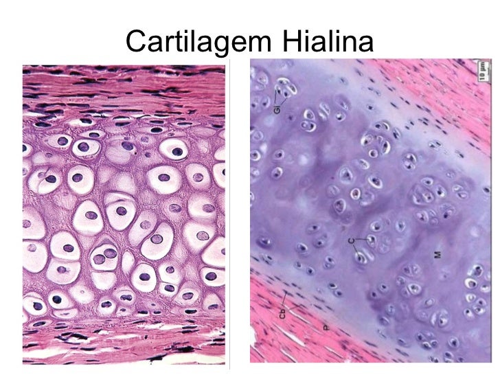Tecido Cartilaginoso