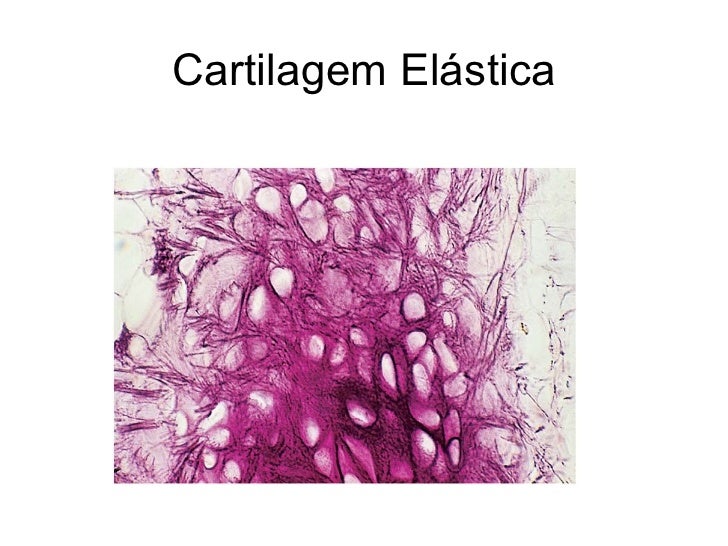 Tecido Cartilaginoso