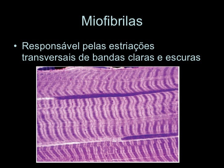 Tecido Muscular