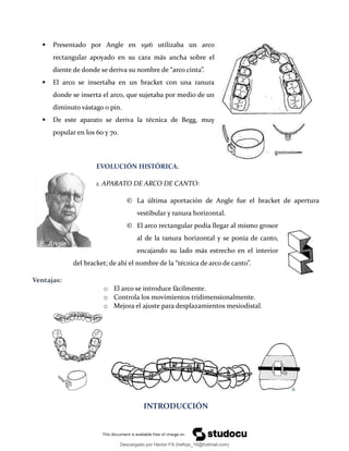 tecnica-edgewise-standar ortodoncia....... | PDF