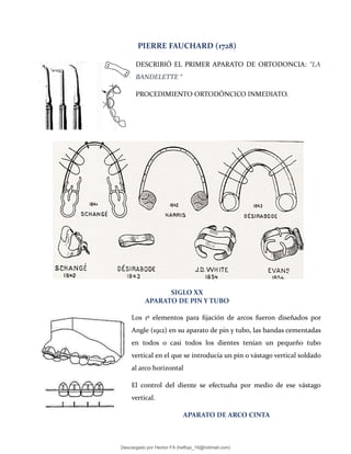 tecnica-edgewise-standar ortodoncia...... | PDF