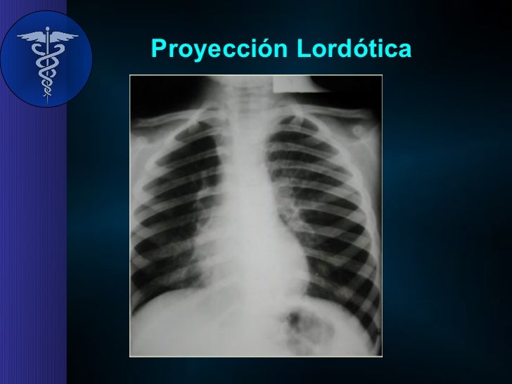 Tecnica Exploracion Torax