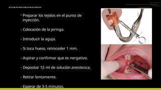 Tecnica anestesia MANDIBULA.pptx cirugia bucal | PPTX
