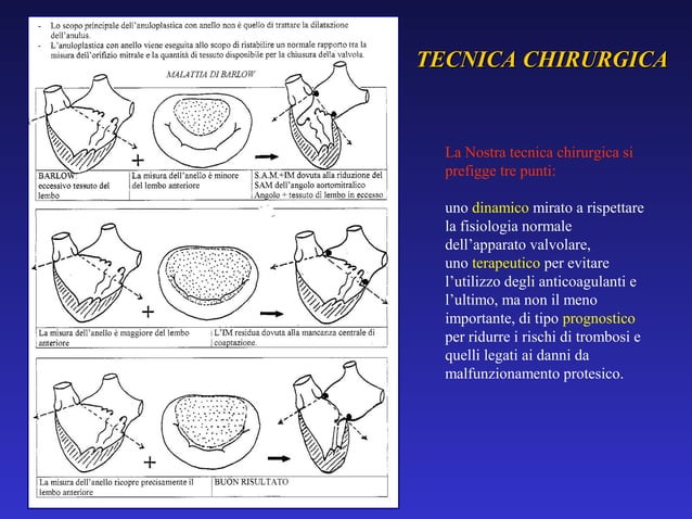 Tecnica chirurgica innovativa nella malattia di barlow | PPT
