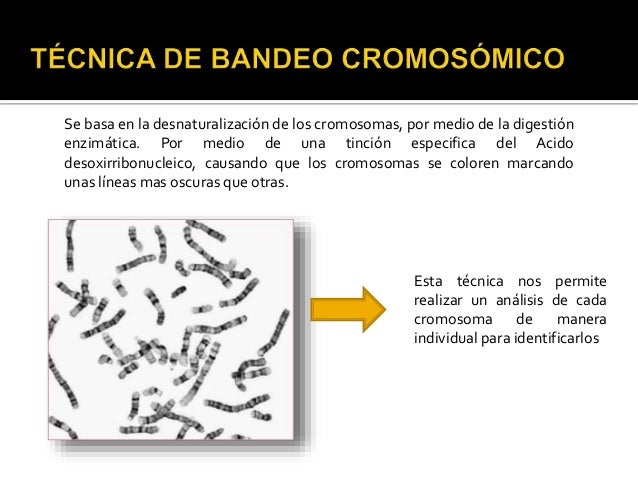 Técnica de bandeo cromosomico