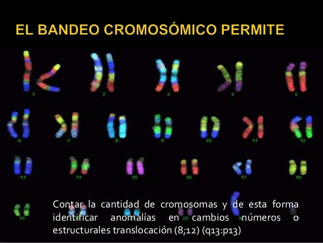 Técnica de bandeo cromosomico